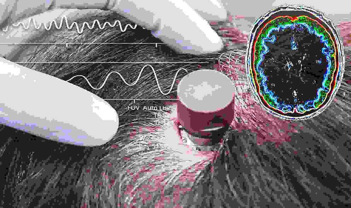 Musks Neuralink Now Recruiting For 1st Human Trial Of Its Brain