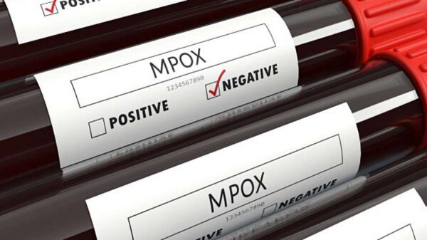 SOUTH AFRICA: MPOX CASES RISE TO 16, DEATH TOLL INCREASE TO THREE